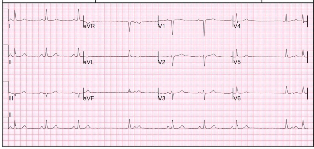 EKG Course | ResponseHealthcareEducation